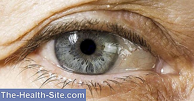 Diabetinė Retinopatija: Priežastys, Gydymas 💊 Mokslinė-Praktinė Medical ...