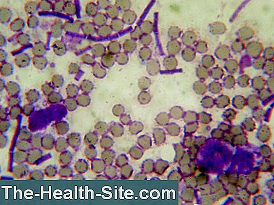 Ántrax: Infección, Síntomas, Tratamiento 💊 Científico-Práctico Medical ...