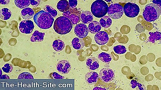 Leucocitosis: Lo Que Significa La Prueba De Sangre 💊 Científico ...