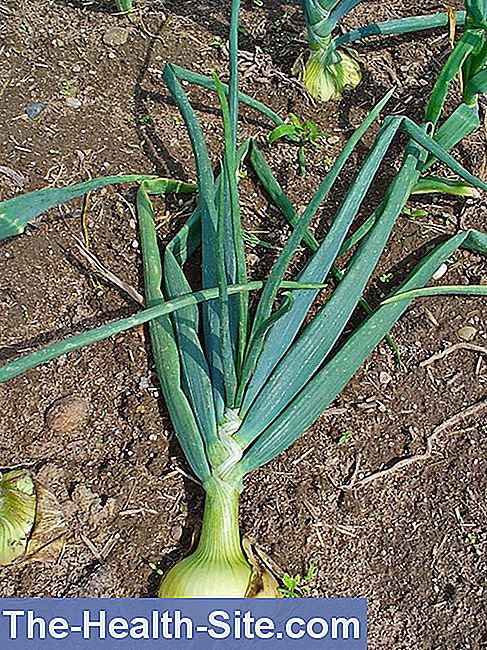 Allium Cepa: Efectos Y Aplicaciones 💊 Científico-Práctico Medical ...