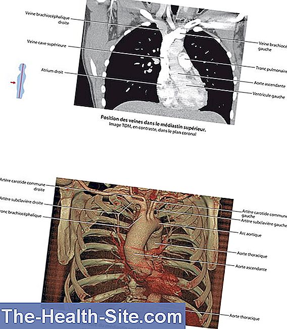Médiastin: Fonction, Anatomie, Maladies 💊 Scientifique Et Pratique ...