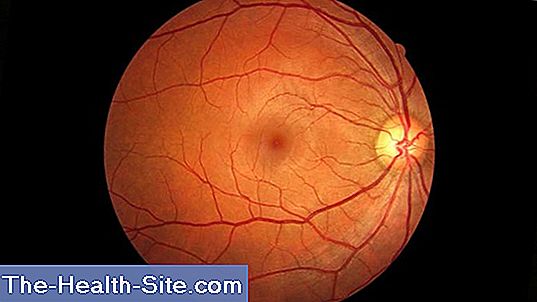 Funduscopy (Oftalmoscopia): Ragioni E Procedure 💊 Scientifico-Pratico ...