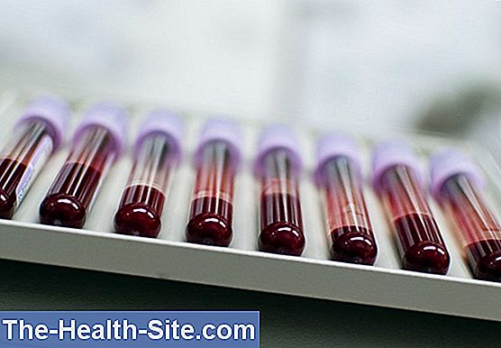 Lipasi: Cosa Significa Il Valore Del Sangue 💊 Scientifico-Pratico ...