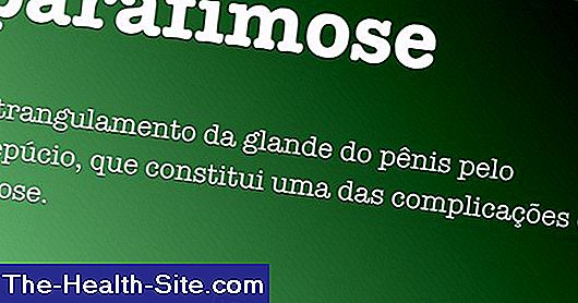 Parafimose 💊 Científico-Prática Medical Journal - 2025