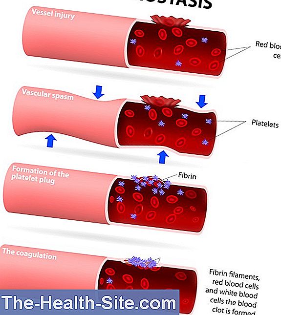 Hemostas: Vad Det Betyder 💊 Scientific-Praktisk Medical Journal - 2025