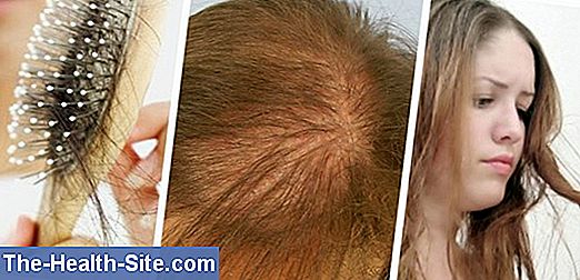 Los Problemas Del Cabello 💊 Científico-Práctico Medical Journal - 2025